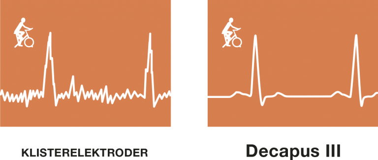 decapus-3_0003_smart-vektorobjekt – Cardiolex – Easy to use ECG