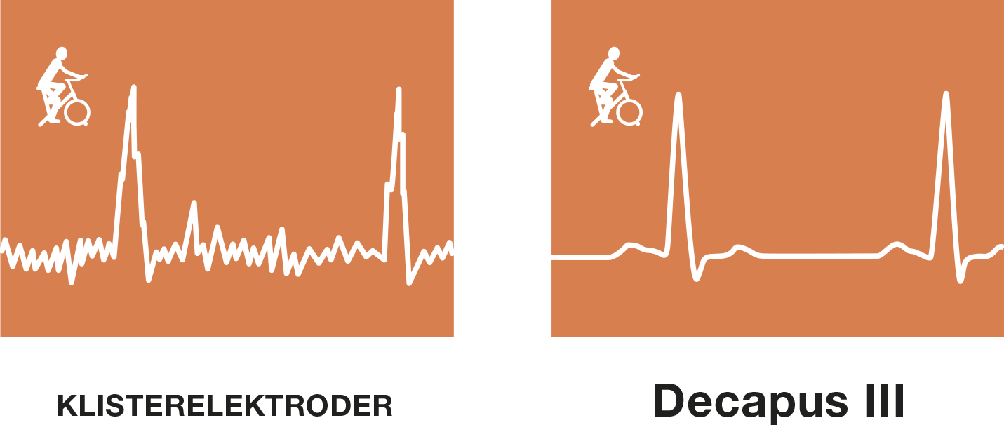 decapus-3_0003_smart-vektorobjekt – Cardiolex – Easy to use ECG