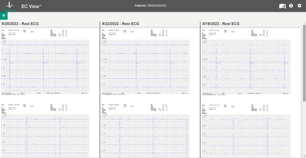 EC View web is here – Cardiolex – Easy to use ECG